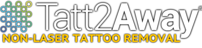 Tatt2Away Tattoo Removal | Non-Laser, Safe, and Effective - Tattoo ...